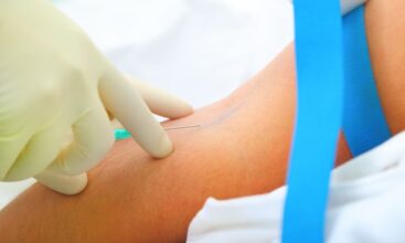 The Best Veins To Choose for IV Insertion